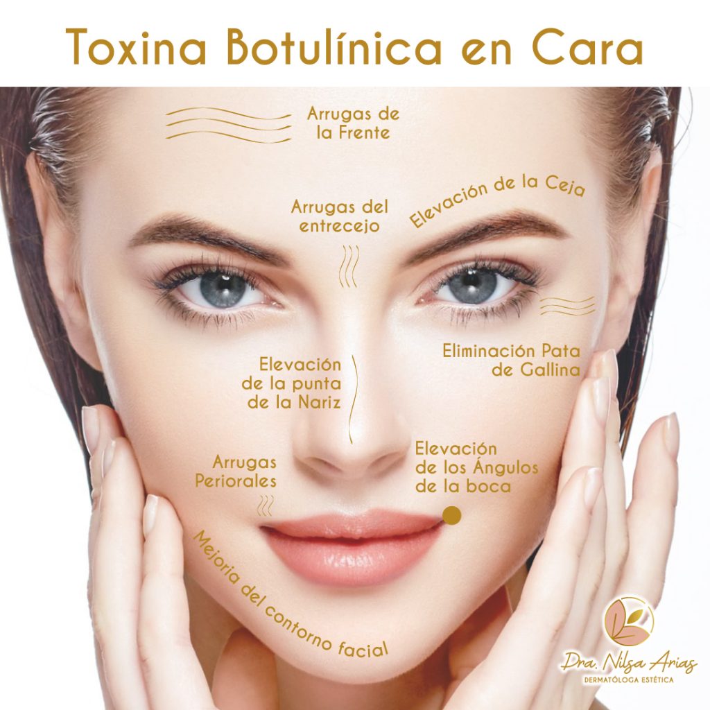 Toxina Botulínica - Dra Nilsa Arias